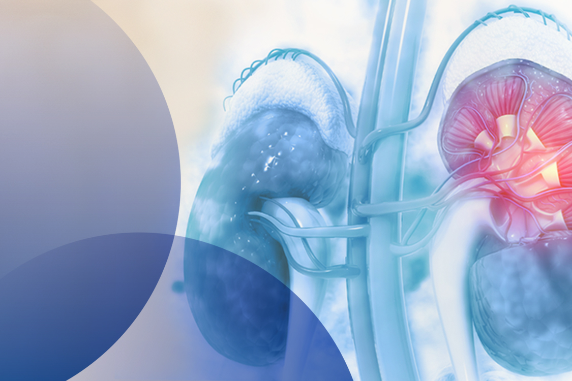 Calliditas Therapeutics and STADA partner | STADA